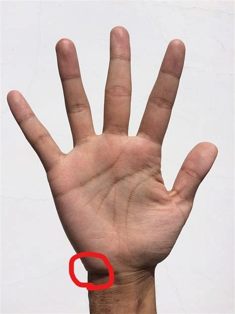 手首の小指側が痛むのは・・・ あお整骨院 笠間院