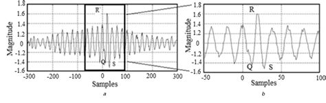 Figure 5 From Real Time Cross Correlation Based Technique For Detection And Classification Of