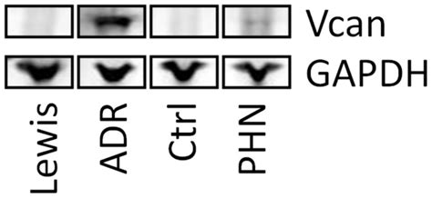 versican protein expression is induced in two rat models of