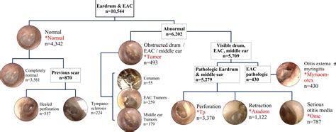 Automated Diagnosis Of Ear Disease Using Ensemble Deep Learning With A Big Otoendoscopy Image