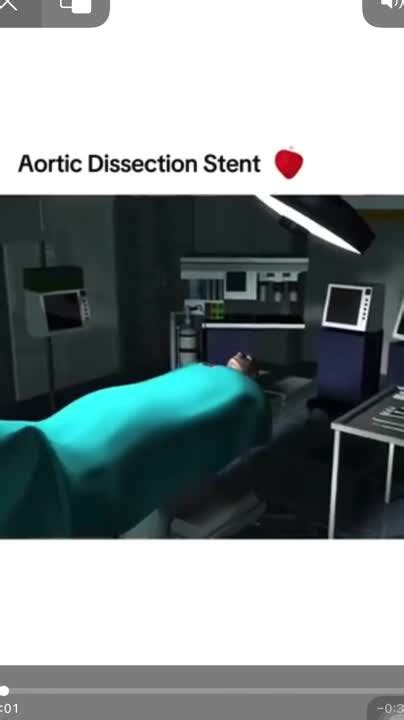 Dr S Atheena Milagi Pandian On Linkedin An Aortic Dissection Stent