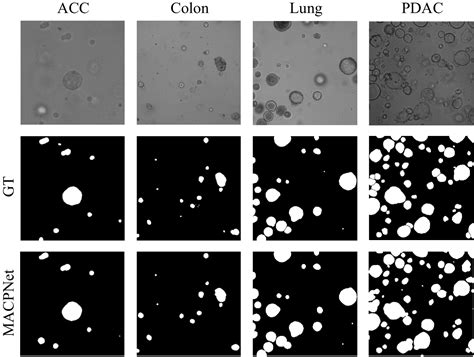 Multi Axis Attention With Convolution Parallel Block For Organoid