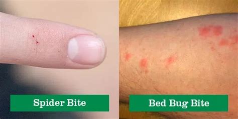 How To Identify Bed Bug Bites The Complete Guide