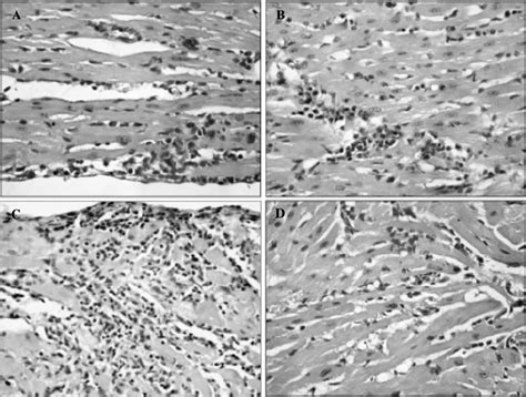 Mononuclear Inflammatory Infiltrates In Cardiac Muscle Tissue During