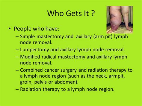 Lymphedema By Angelicque Ernandez October Th Ppt Download