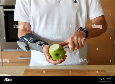 The Rehabilitation Device Based On Functional Electrical Stimulation Fes That Generates