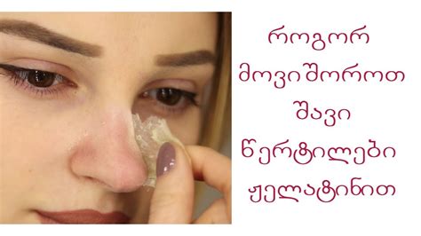 როგორ მოვიშოროთ შავი წერტილები ჟელატინით Youtube