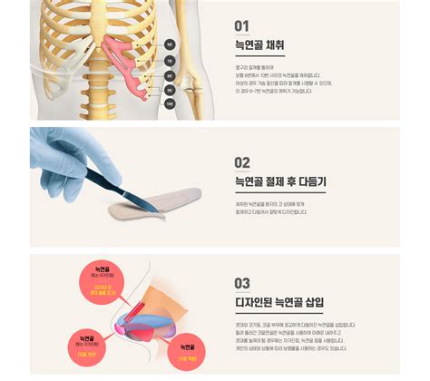 루브르성형외과 처음처럼 자연스럽게 코재수술구축코 교정술