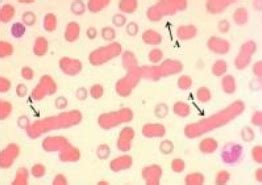 LEC MORPHOLOGIC EVALUATION OF ERYTHROCYTES Flashcards Quizlet
