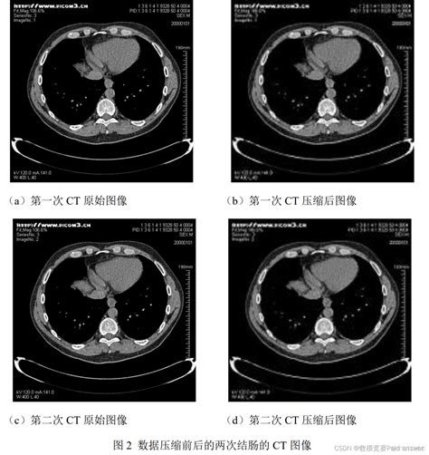 医学图像配准 刚体变换配准和仿射变换 Python 医学图像配准建模mob64ca140b82e3的技术博客51cto博客