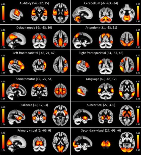 Static Group Spatial Functional Connectivity Maps Of The Twelve Brain