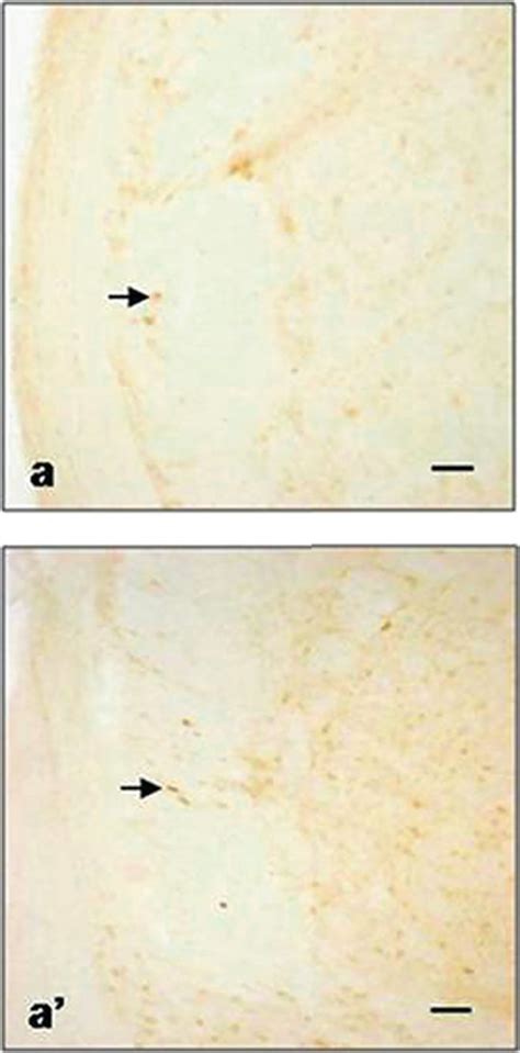 Nnos Positive Neurons In The Ipsilateral Spinal Trigeminal Nucleus A Download Scientific