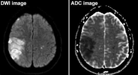 Richards Practice Mri Exam Flashcards Quizlet