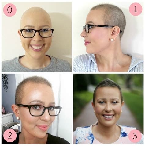 Hair Growth And Styling Tips For Short Hair After Chemo