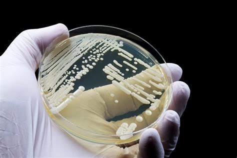 Newfound Compound Kills Multi Drug Resistant Fungi
