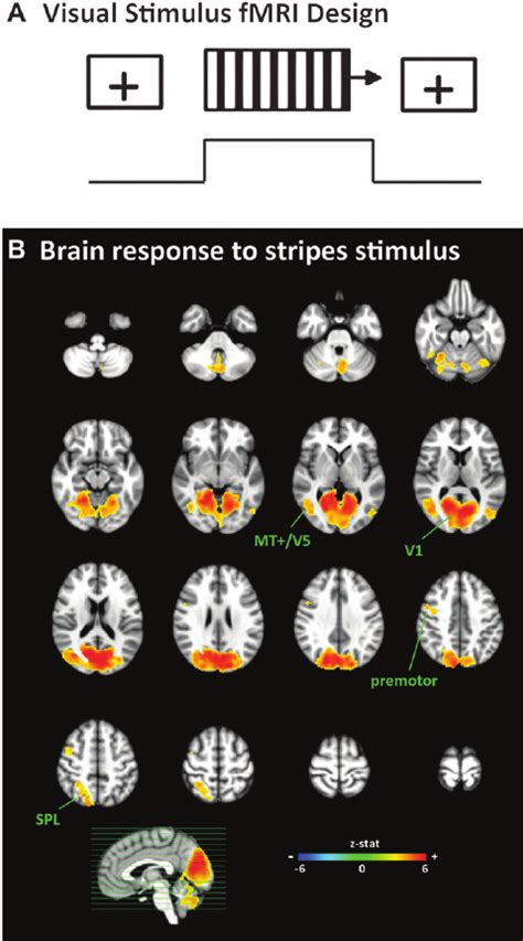 Brain Fmri Response To Visual Stimulation With Translating Stripes A Download Scientific