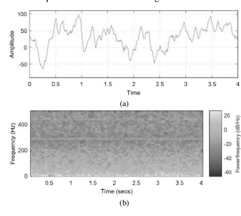 Figure From Analysis Of EEG Signal Processing Techniques Based On Spectrograms Semantic Scholar