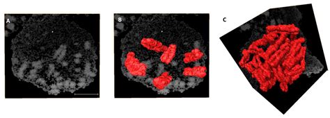 Ijms Free Full Text Ultra Structural Imaging Provides 3d Organization Of 46 Chromosomes Of A