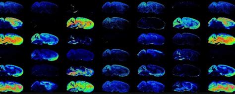 Mass Spectrometry Imaging