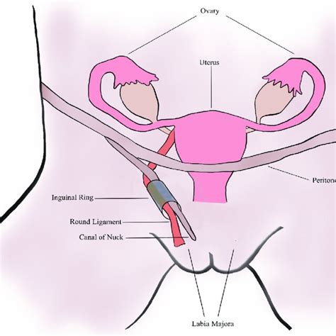 A Schematic Of The Female Anatomy And The Patent Canal Of Nuck Download Scientific Diagram