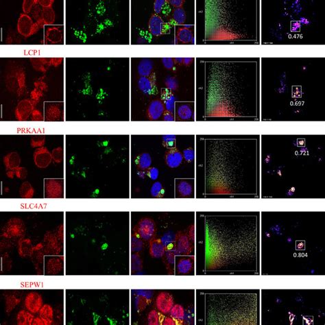 Manders Colocalization Coefficient Mcc Values Quantify The Different Download Scientific