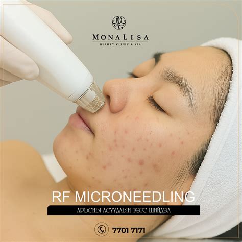 Mona Rf Microneedling Арьсны гүнээс шинэчлэл Арьсаа залуужуулж уян хатан болгох хамгийн үр
