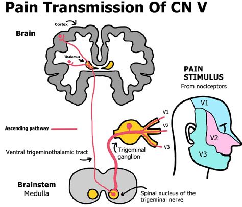 Trigeminal Neuralgia Focus Dentistry