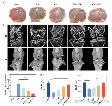 南方医科大学与西南交通大学携手攻克骨关节炎治疗难题：新型可注射硫酸软骨素微球，兼具抗炎与软骨修复双重功能 知乎
