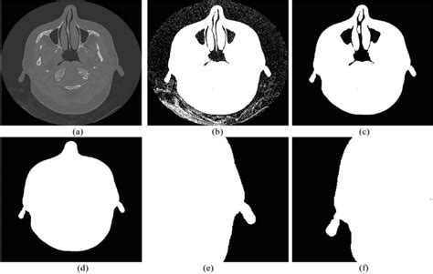 A Binary Segmentation Mask To Extract Mastoid Region A Original Image