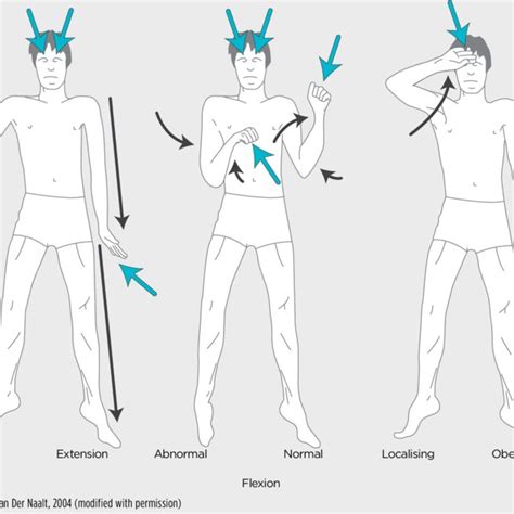Motor Responses In Glasgow Coma Scale Download Scientific Diagram