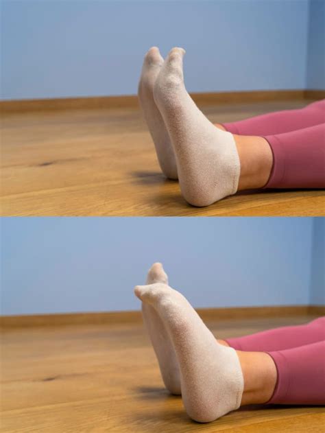 Fifth Metatarsal Fracture Early Exercise Programme Pure Physiotherapy
