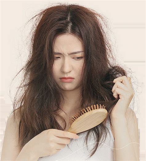 0628 人物 秃顶 脱发掉发 育发 梳头素材 32 花瓣网