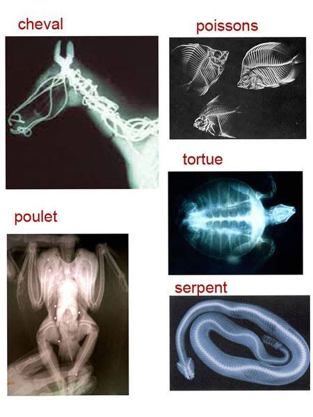 X Ray Body Part Matching Activity Human Body Activities Human Body Human Body Science