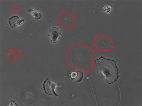How Do I Ignore Specific Shapes On Image Processing Opencv Python