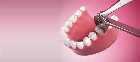 Tooth Extraction Post Operative Care Monash Dental Group