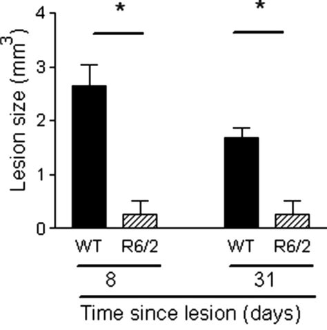 R62 Mice Are Resistant To Qa Induced Striatal Toxicity R62 Mice Had