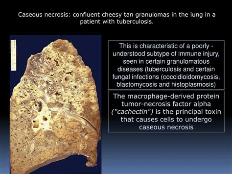 Ppt Necrosis And Apoptosis Powerpoint Presentation Free Download