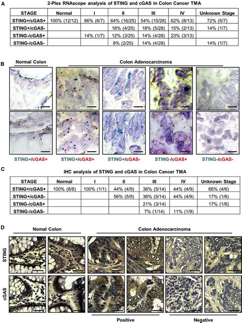 Rna In Situ Hybridization Analysis In Colon Cancer Tissue Microarray
