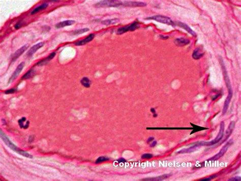 Solved 1 The Function Of The Indicated Elastic Lamellae Of
