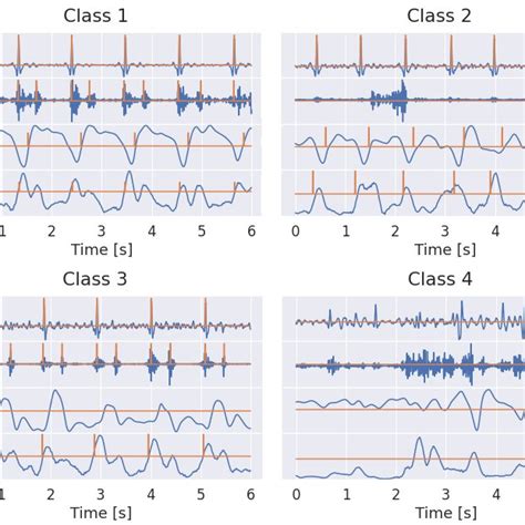 Examples Of Labeled Signals In The Four Different Classes Ecg Pcg Download Scientific