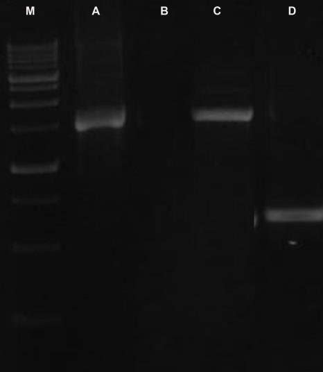 Electropherogram From 16srna Gene Amplification On Clove Plants From