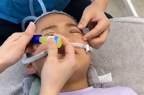 남자는 돈 여자는 외모 일본서 9세 딸 쌍꺼풀 수술시킨 엄마 뭇매