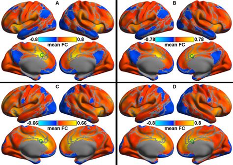Intrinsic Functional Connectivity Ifc Of The Dorsal Anterior Download Scientific Diagram