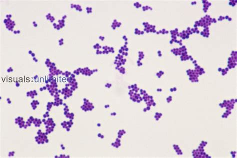 Gram Staining Procedure Visuals Unlimited