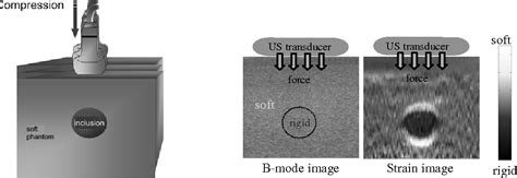 Figure 2 From Palpation Imaging Using A Haptic System For Virtual Reality Applications In