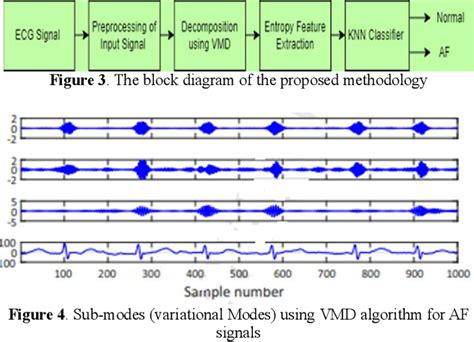 Figure 4 From Computer Aided Detection Of Atrial Fibrillation Episodes From Electrocardiogram