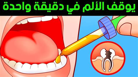 اقوى علاج لالتهاب الاسنان
