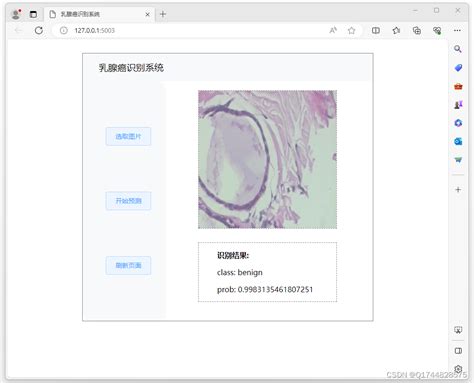 深度学习之基于vgg16卷积神经网络乳腺癌诊断系统 Csdn博客