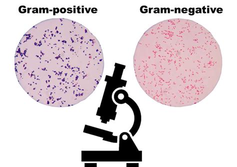 Bacillus Gram Stain Micro Biology Lab 1 Bacteria Gram Stains And