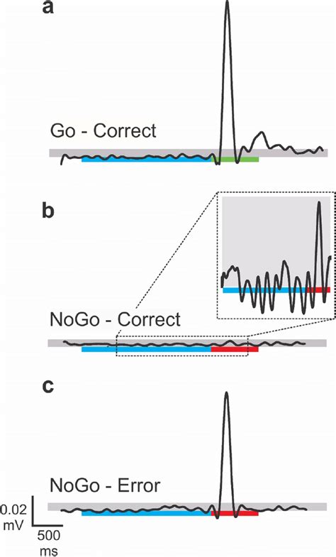 Emg Threshold Detection Example Emg Activity Black Line Is Shown